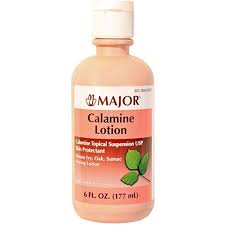 Major Calamine Lotion 177ml – Pewex Pharmacy